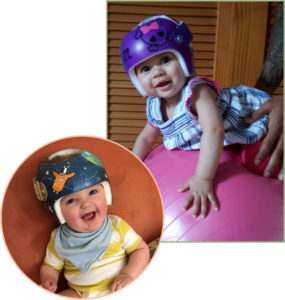 Cranial Helmets | Human Technology Prosthetics & Orthotics