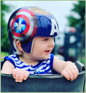 Cranial Helmets | Human Technology Prosthetics & Orthotics