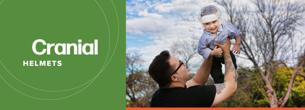 Cranial Helmets | Human Technology Prosthetics & Orthotics