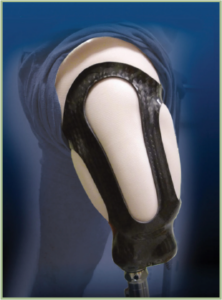 Sockets & Suspension | Human Technology Prosthetics & Orthotics