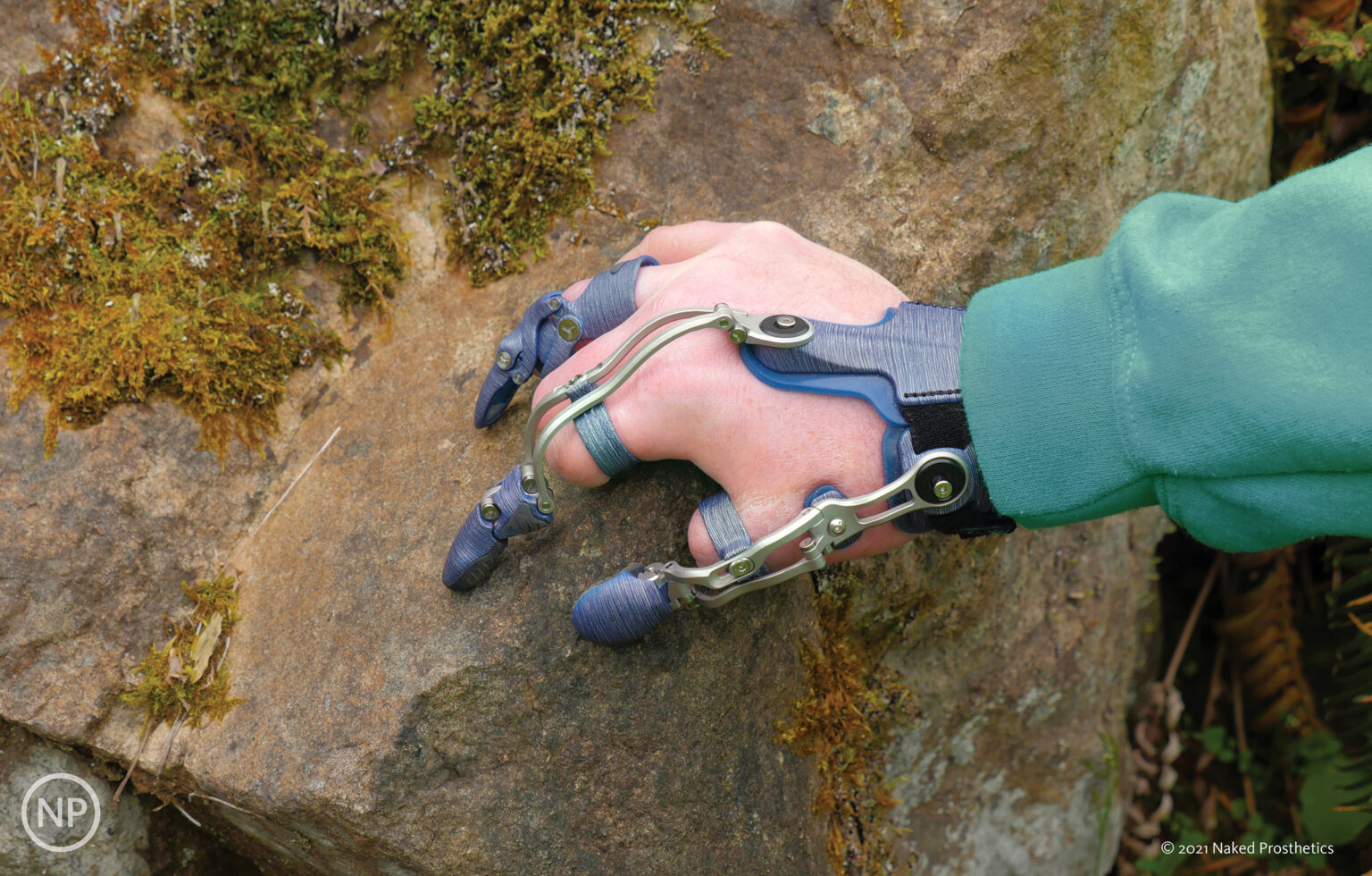 Upper Extremity | Human Technology Prosthetics & Orthotics