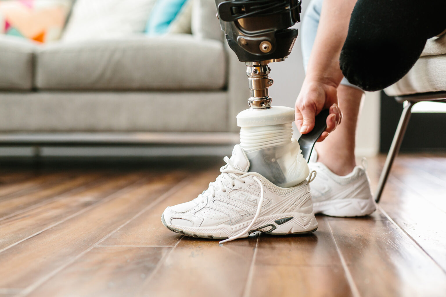 Lower Extremity Amputation Types